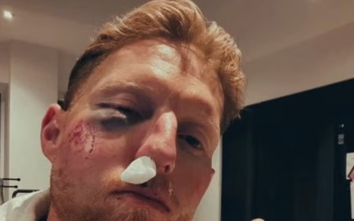 'Cricket Balls Do Serious Damage': Stokes Vows To 'always Wear Helmet ...